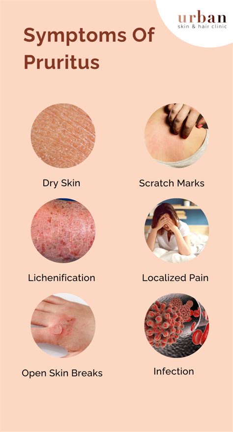 Pruritus Types Causes Symptoms And Treatment Ushc