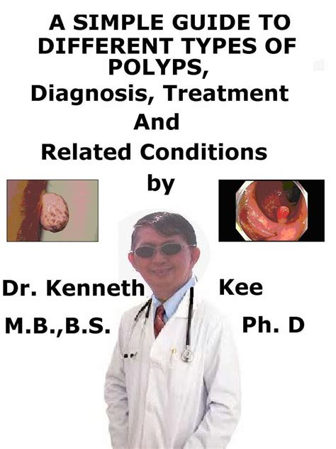 A Simple Guide To Different Types Of Polyps Diagnosis Treatment And Related Conditions By