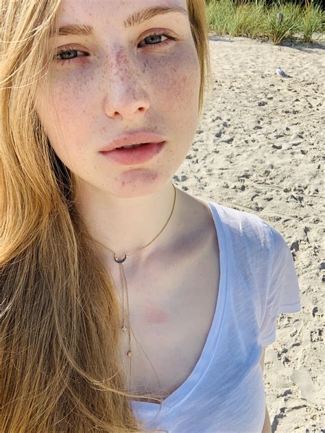 I Miss Those Sunny Days 💝 R Freckledgirls