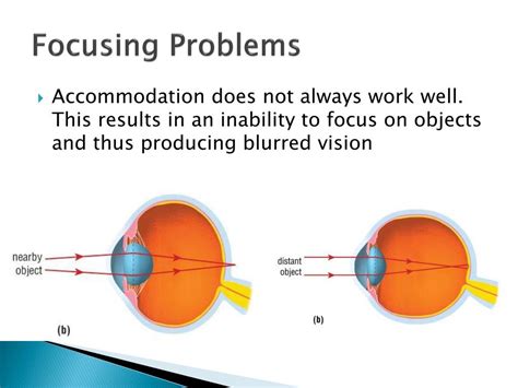 Ppt 12 3 The Human Eye Powerpoint Presentation Free Download Id