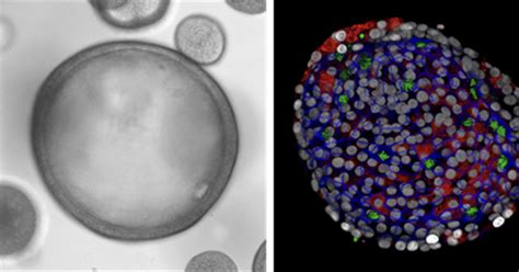 Stem Cell Models For Personalized Treatment Of Rare Genetic Diseases Health~holland