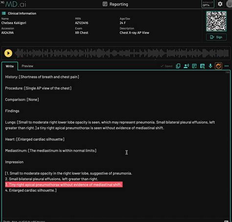 Reporting Product Mdai