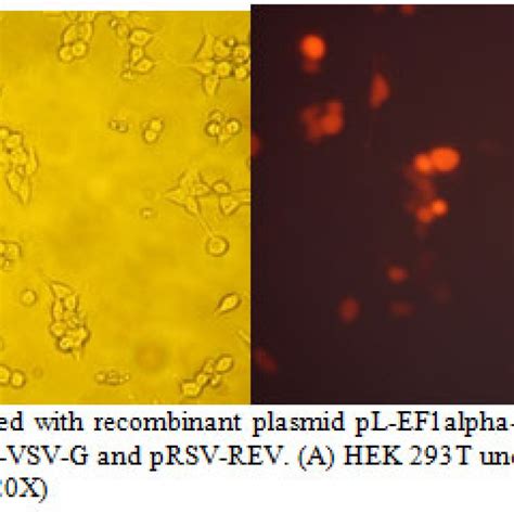 Lentivirus Based System For Fast Expression And Purification Of Recombinant Proteins And Its
