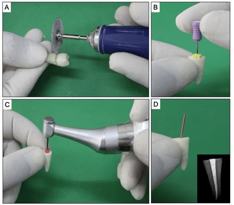 Comparative Evaluation Of Apical Leakage In Root Canal Obturation Using Ah Plus Sealer