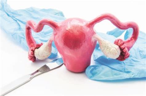 Reporting A Repeat Pap Smear Zero In On Your E M Codes Gynecology