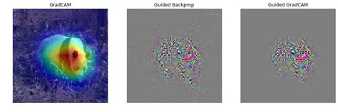 Efficientnet Keras Gradcam Visualization