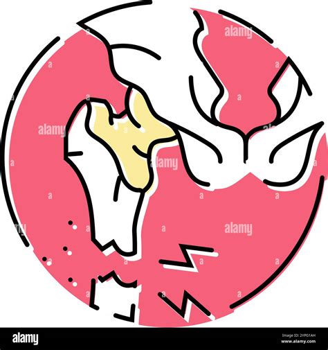 Hip Fracture Osteoporosis Bone Color Icon Vector Illustration Stock