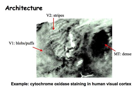 Perception Lecture Notes Cortical Visual Areas And Pathways