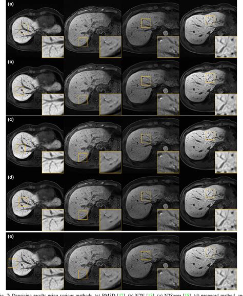Figure 1 From Mr Image Denoising And Super Resolution Using Regularized
