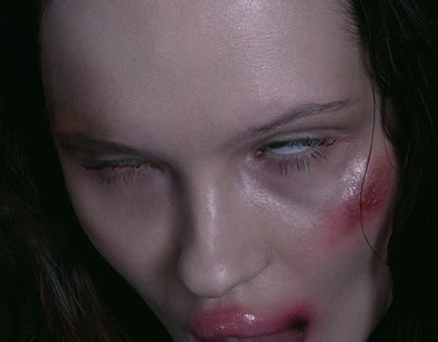 Bonnie Bruise Projects Photos Videos Logos Illustrations And