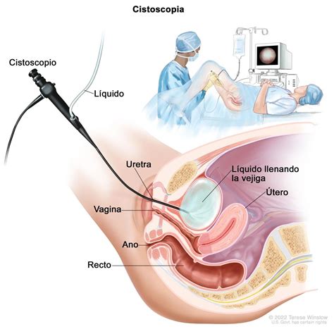 Cistoscopia En Hombres Todo Lo Que Necesitas Saber Doctor Online