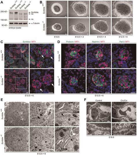 Development Of Podocyte Foot Processes In Cultured Embryonic Scribble Download Scientific