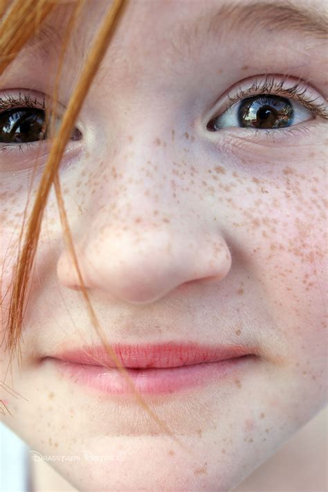 Look Into My Eyes Freckles Nose And Cheeks Redheads With Brown