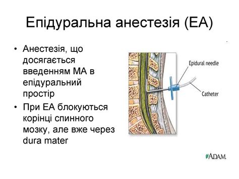 Анестезія з використанням місцевих анестетиків - презентация онлайн