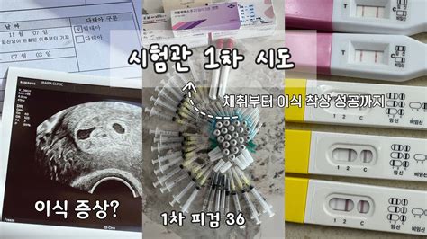 시험관 동결이식 착상성공 낮은 피검 예후 Youtube