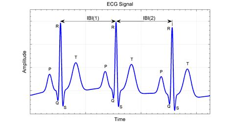 IBI Extraction Jramshur HRVAS GitHub Wiki