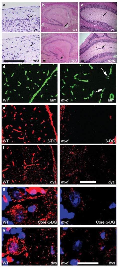 Abnormal Neuronal Migration And Dystroglycan Associated Protein Download Scientific Diagram