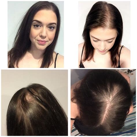 Hair Topper101 How To Style A Hair Topper Quickly Make The Hairline