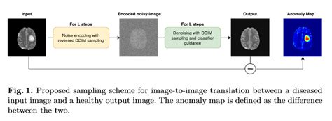 Diffusion Models For Medical Anomaly Detection 知乎