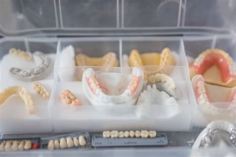 Types Of Removable Partial Dentures European Denture Center