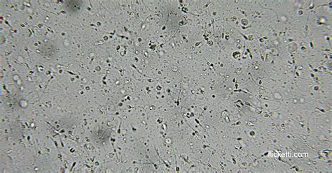 Sperm Microscope 400x