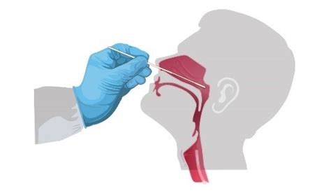 Laboratory Testing For Mers Mers Cdc
