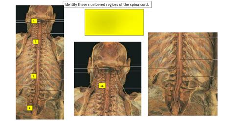 Back And Spinal Cord Lab Quiz 1 Diagram Quizlet