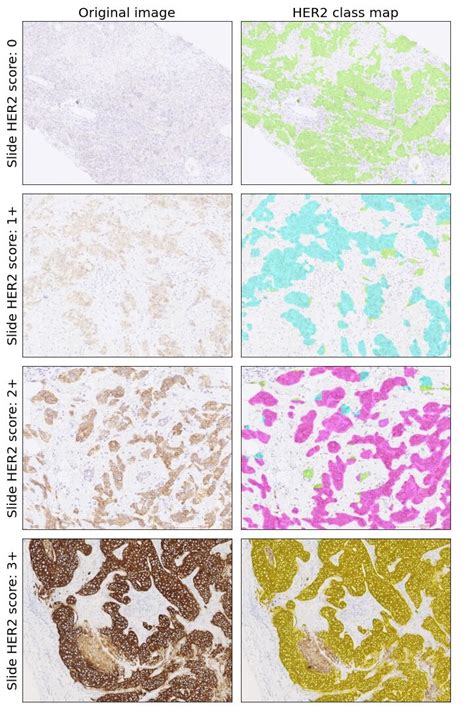 Visualization Of The Her2 Patch Classification Model Output Class 0