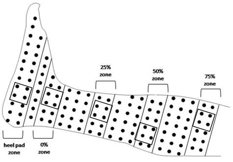 Figure 1 From The Effects Of Sex Leg Region And Impact Technique On Leg Soft Tissue Motion And