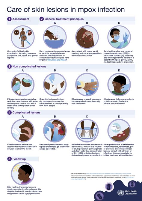 Public Advice On Protecting Yourself From Mpox