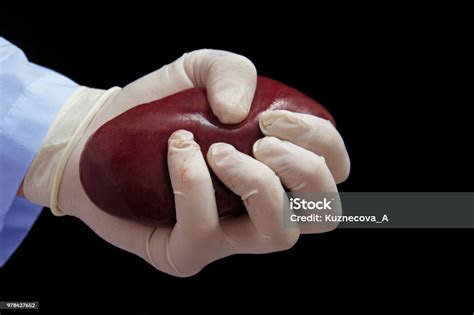 지 하 신장 이식 수술 개념입니다 불법 장기 이식입니다 인간의 신장 이식 외과 의사의 손에입니다 시신 기증자 신장 국제 신장