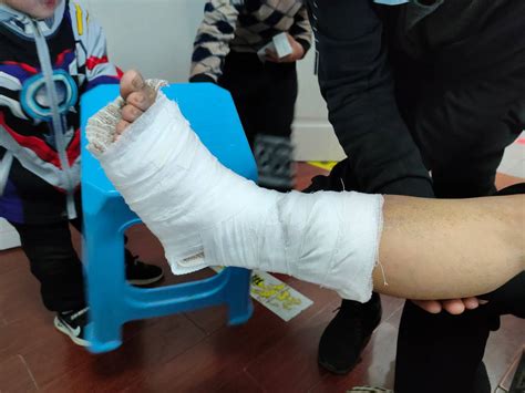 邢台123：邢台市脚崴了哪里治的好，求帮助，崴脚了