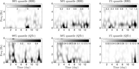 Figure S2 The Spectrogram Results Of The Second Case For A Comparison