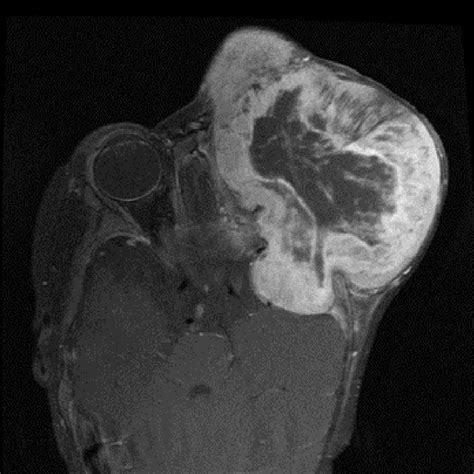 June 27 2024 Case Of The Week American Journal Of Neuroradiology