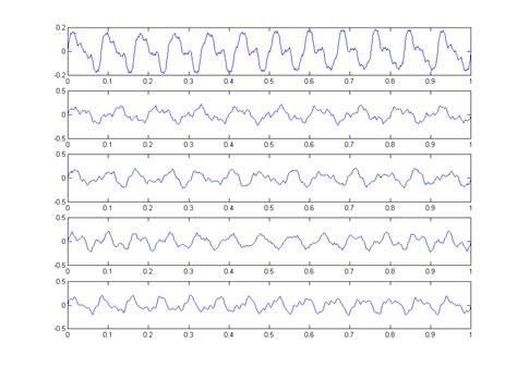 Pseudo Periodic Synthetic Time Series