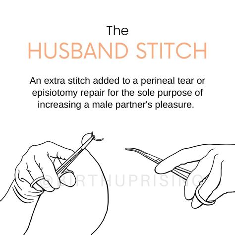 해연갤 독일에 있는 허즈번드 스티치husband Stitch 문화를 알아보자