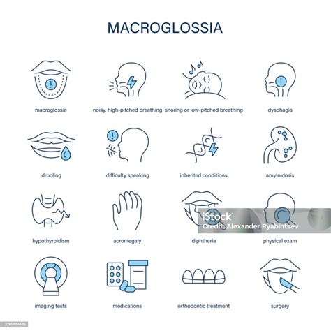 Macroglossia Symptoms Diagnostic And Treatment Vector Icon Set Stock