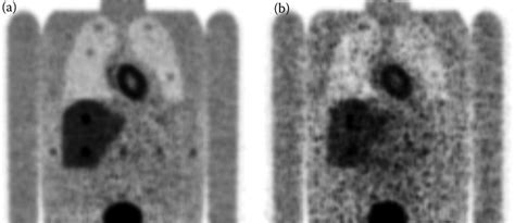 Coronal Slices For Image Volumes Generated By ASIM With Cm Diameter Download Scientific