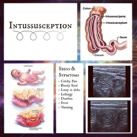 Pin On Nursing School