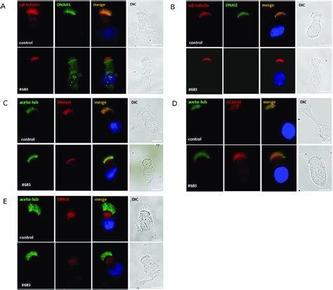 High Resolution Immunofluorescence Analysis Of The Subcellular Download Scientific Diagram