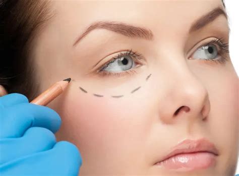 Plexr Non Surgical Blepharoplasty Dr Medispa Award Winning Clinics