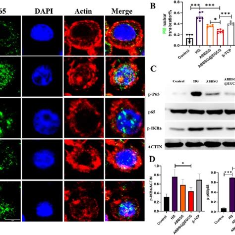Abbsg Egcg Inhibits Nf κb Pathway Activation Under A Diabetic