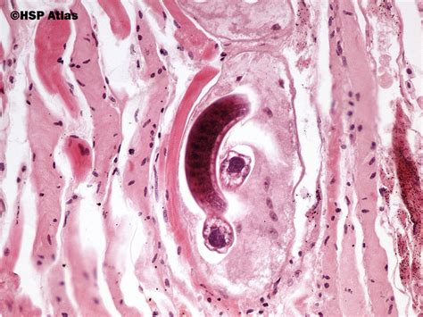Hsp Atlas Histopathology Atlas