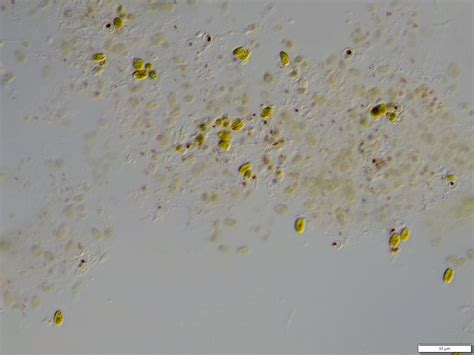 Algaeprocessednoisy Object Detection Dataset By Stuff