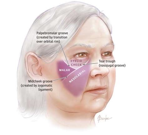 Mohs Surgery And Skin Cancer Reconstruction Stanford Facial