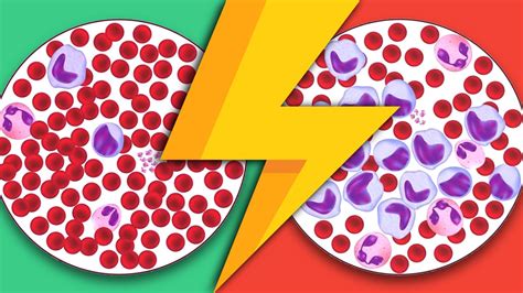 Lightning Learning Immune Thrombocytopenia Itp — Em3