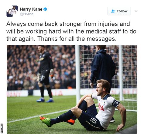 Harry Kane Tottenham Striker Suffers Ankle Ligament Damage Bbc Sport