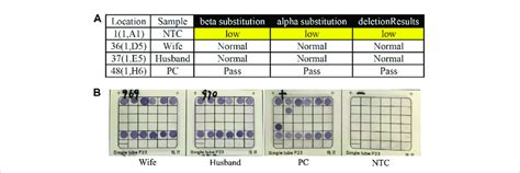 Routine Genetic Assays For 23 Types Of Variations In Hba And Hbb Genes