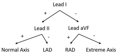 Heart Left Axis Deviation Causes Symptoms Treatment
