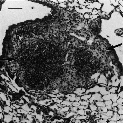 Lung Inflammatory Response 4 D After Intravenous Injection Of 200 Pg Of Download Scientific